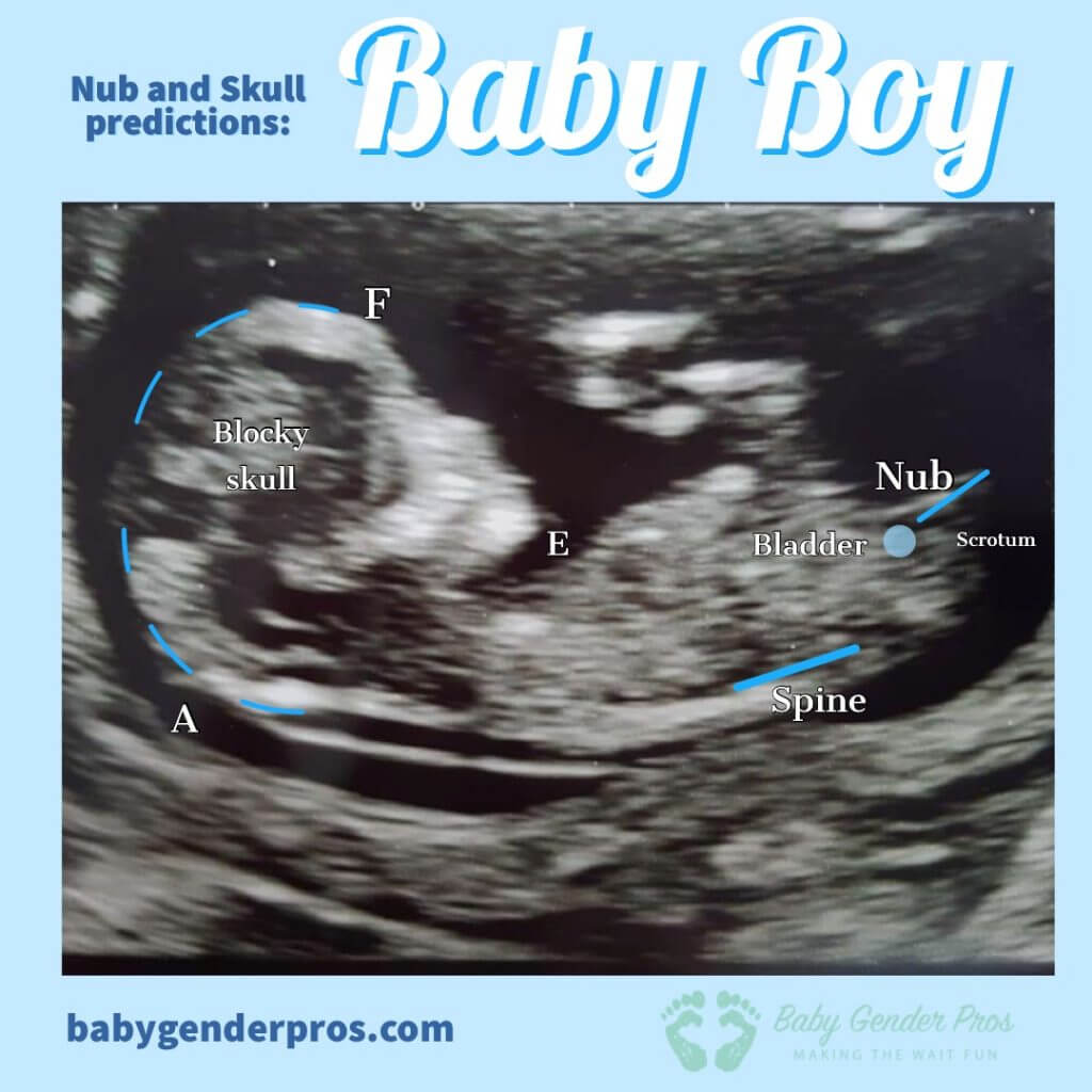 The Evidence Supporting the Skull Theory - Baby Gender Pros